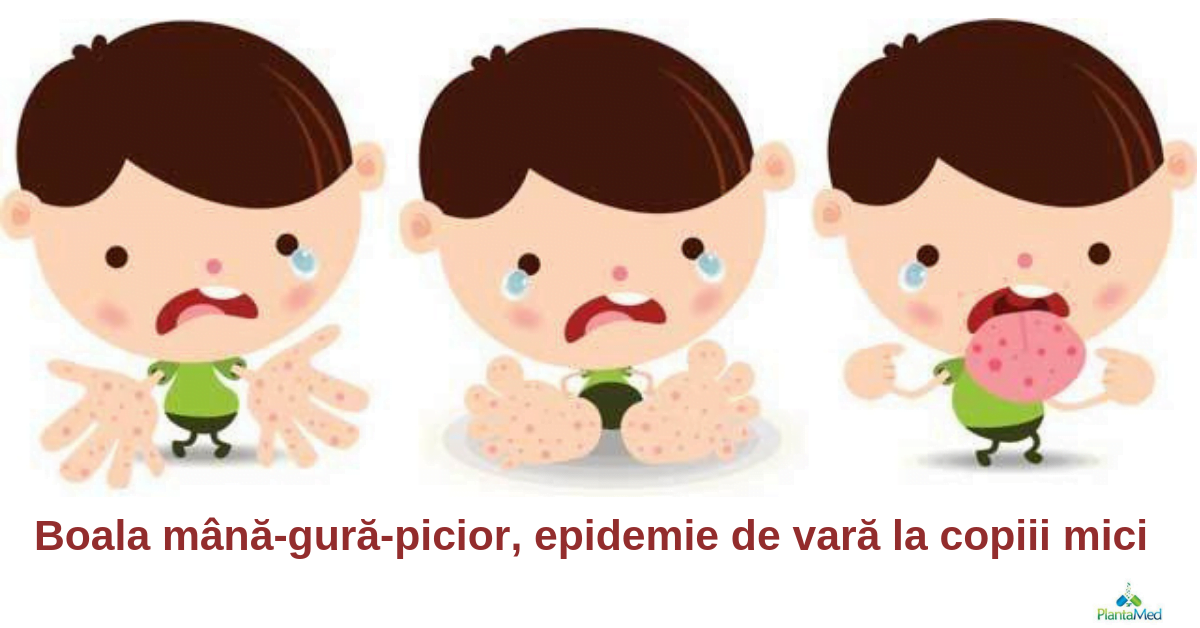 Epidemie de vară la copiii mici. Cum se trateaza boala mână-picior-gură